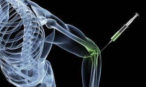 Pain Management in San Jose, Campbell, Santa Clara, Bay Area - Dr ...